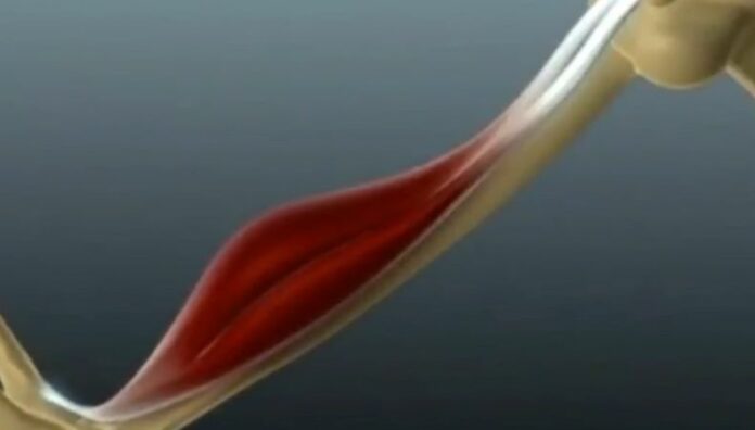 ¿Qué son los calambres musculares?