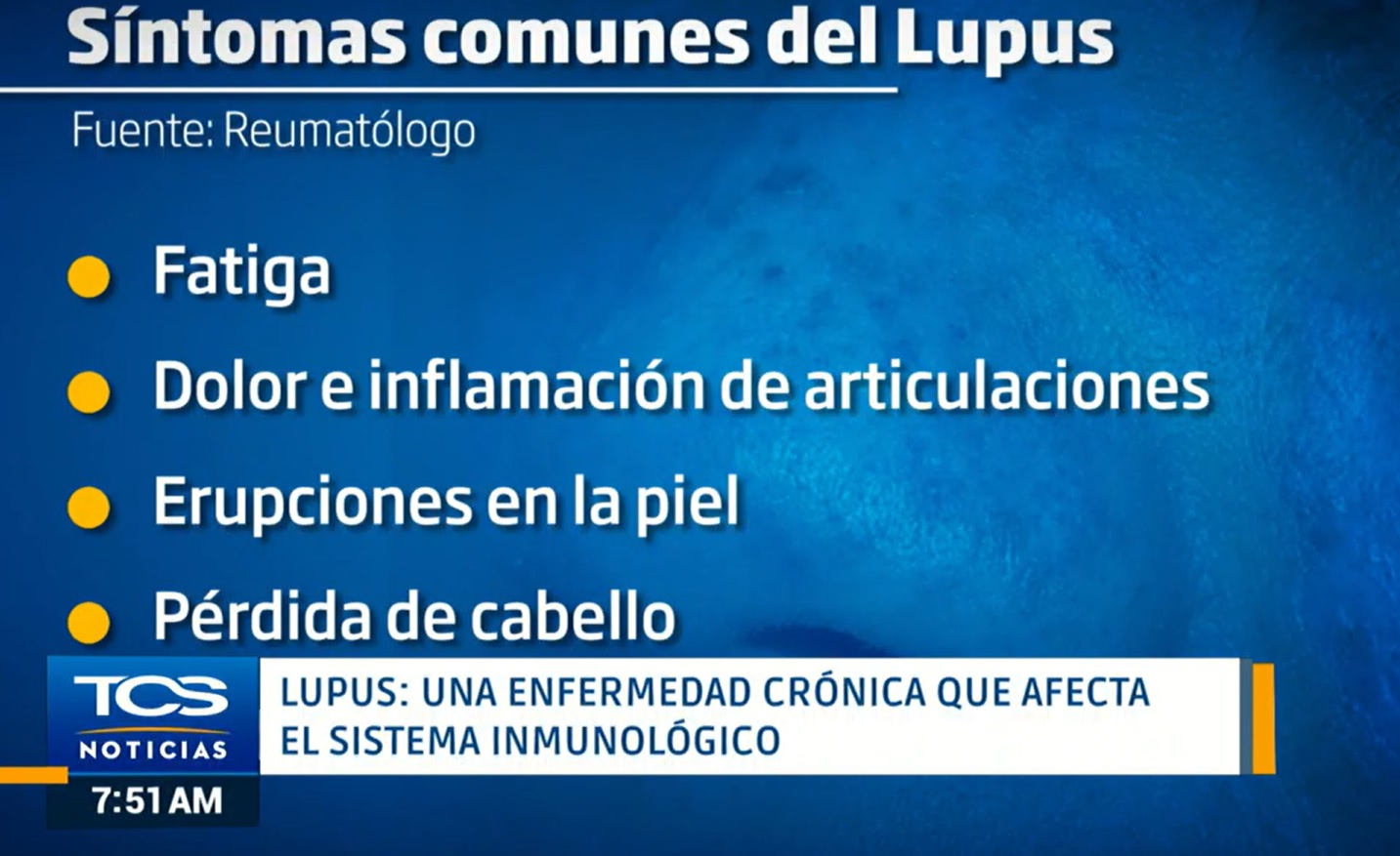 ¿Sabía usted que el lupus afecta más a las mujeres?