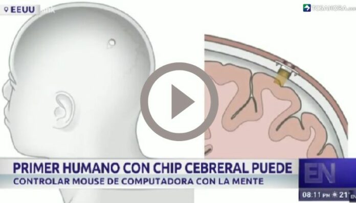 [Video] ¡Primer chip cerebral implantado en un ser humano!